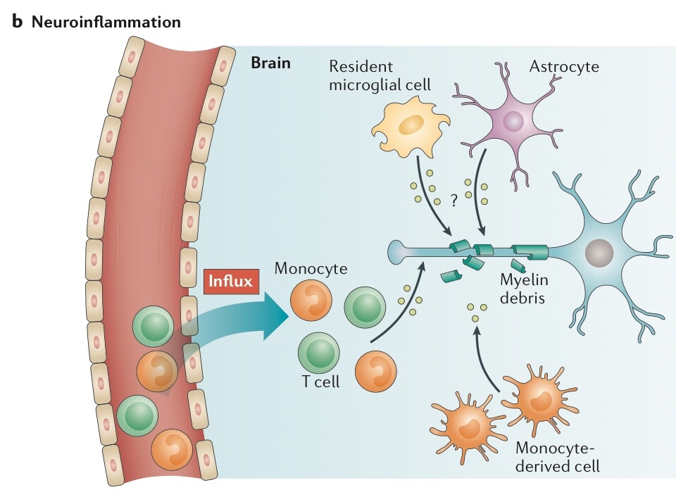 Neuroinflammation vs Neurodegeneration – Red lights on the brain